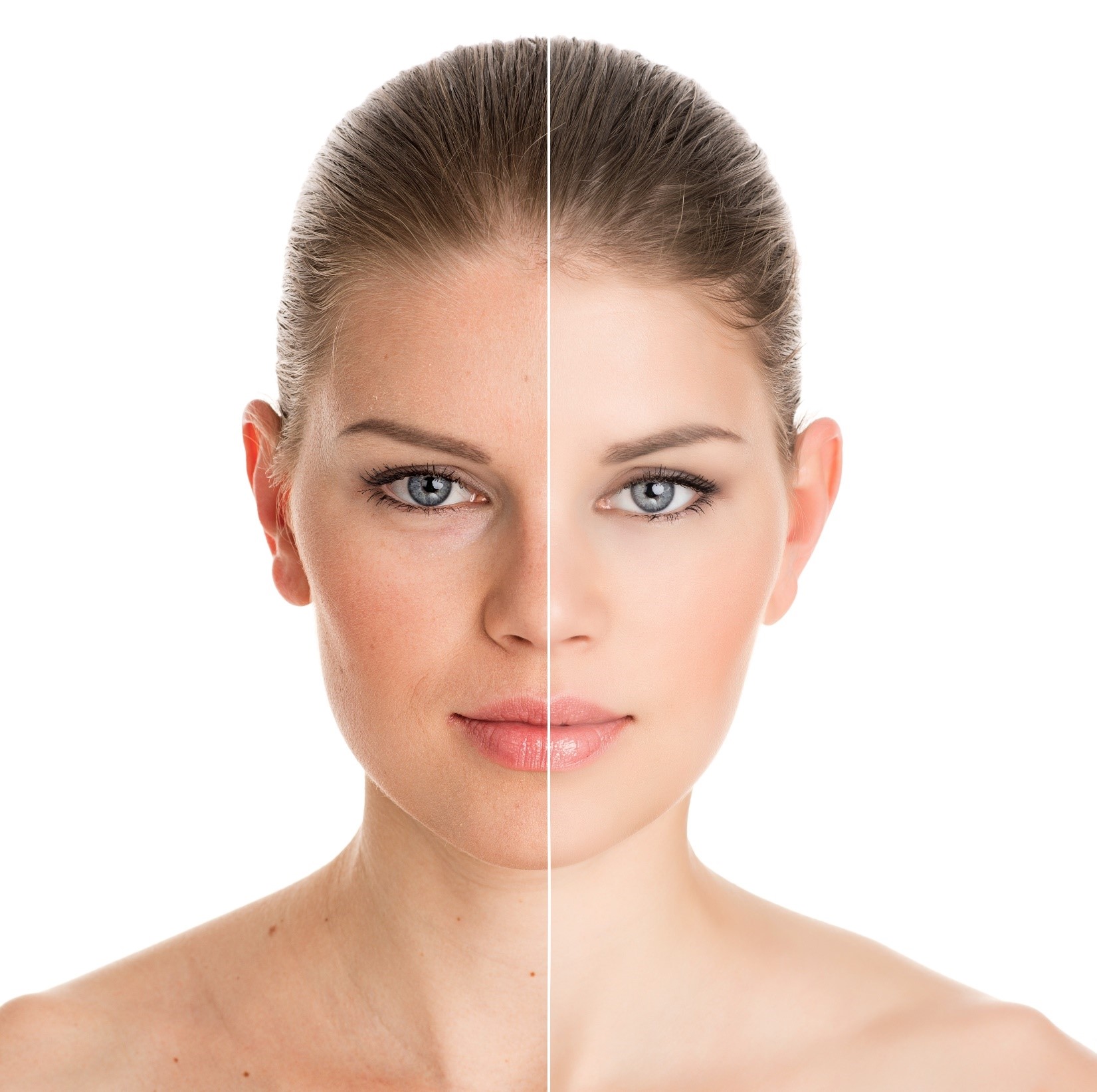 The Perfect Skin Care Routine For Dry Skin 2024 Guide Websta Me