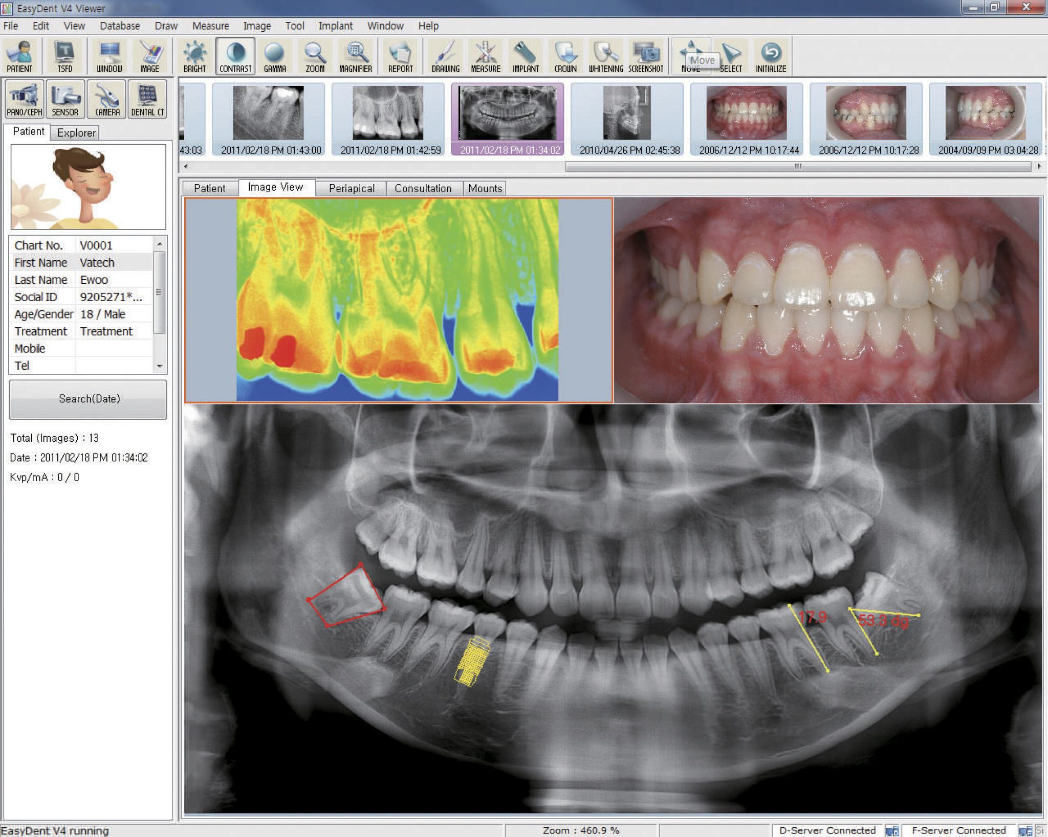 A Guide to Selecting the Right Tools and Software for Your Dental ...