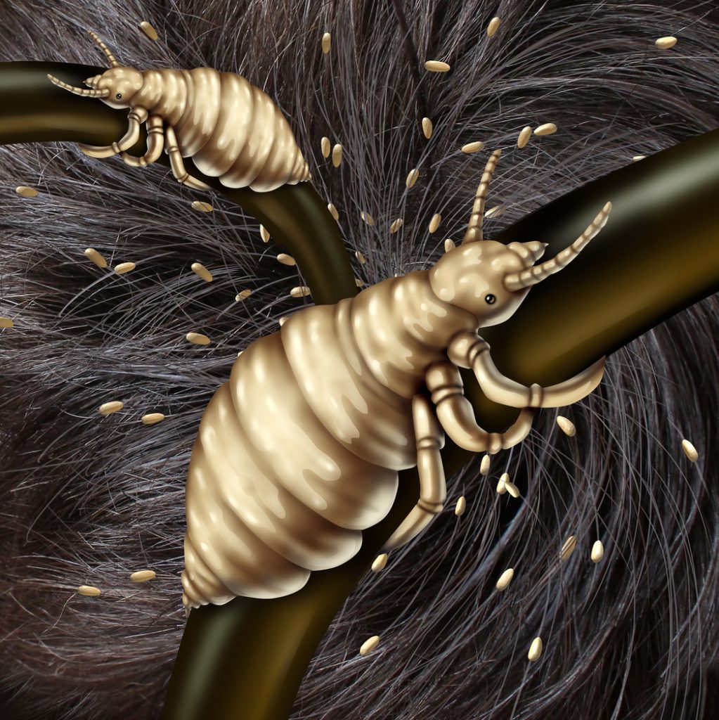 All Kinds Of Essential Details About The Super Lice Treatment - WebSta.ME