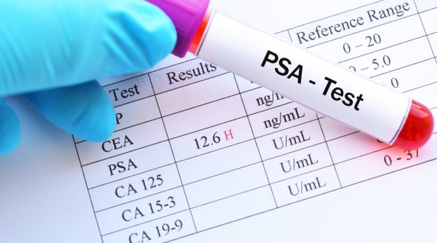Your Guide to PSA Testing - WebSta.ME
