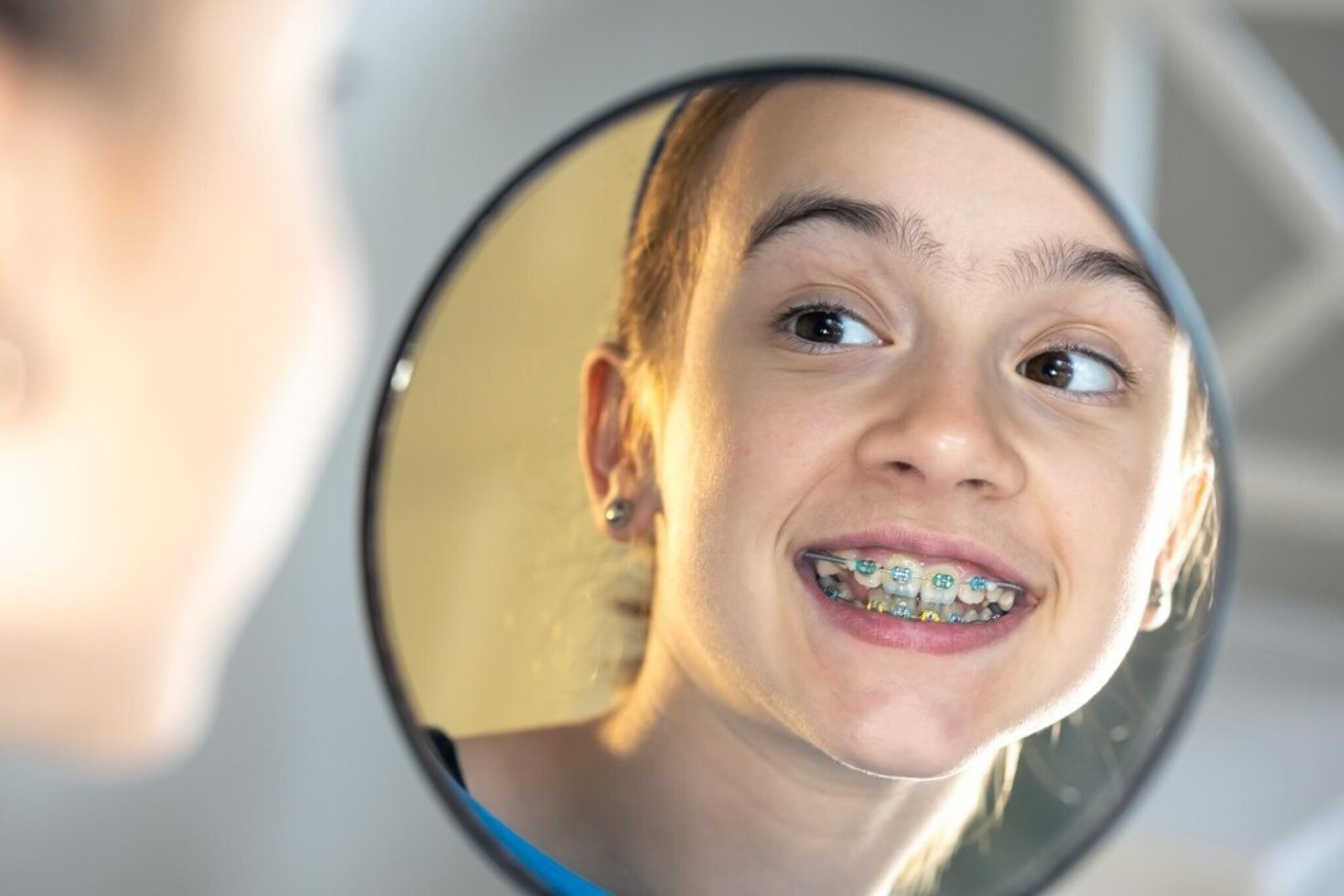 Perfect Bite, Elevate Confidence: Dual Power of Orthodontic Braces ...